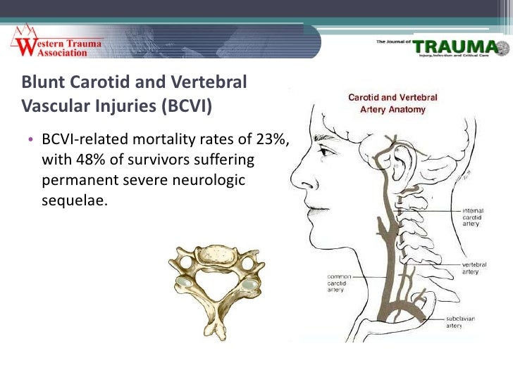Screening for and Treatment of Blunt Cerebrovascular Injuries