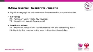 Basic concepts of valvular regurgitation-Echocardiography | PPTX
