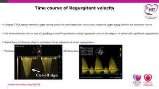 Basic concepts of valvular regurgitation-Echocardiography | PPTX