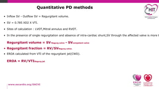 Basic concepts of valvular regurgitation-Echocardiography | PPTX