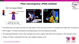Basic concepts of valvular regurgitation-Echocardiography | PPTX