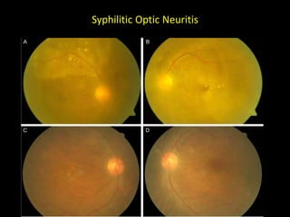 Olfactory and Optic Nerve Neuroanatomy | PPTX