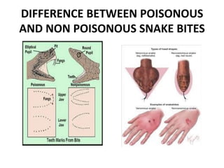 BD Different types snake details management of bite1.pdf