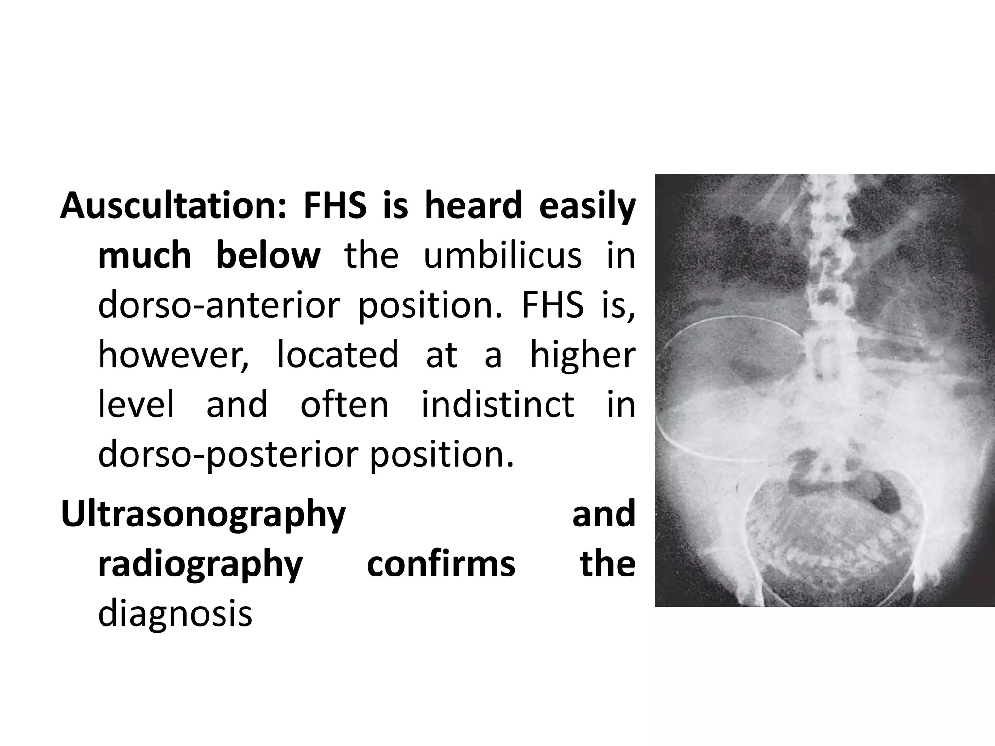 Transverse lie and cord prolapse | PPTX