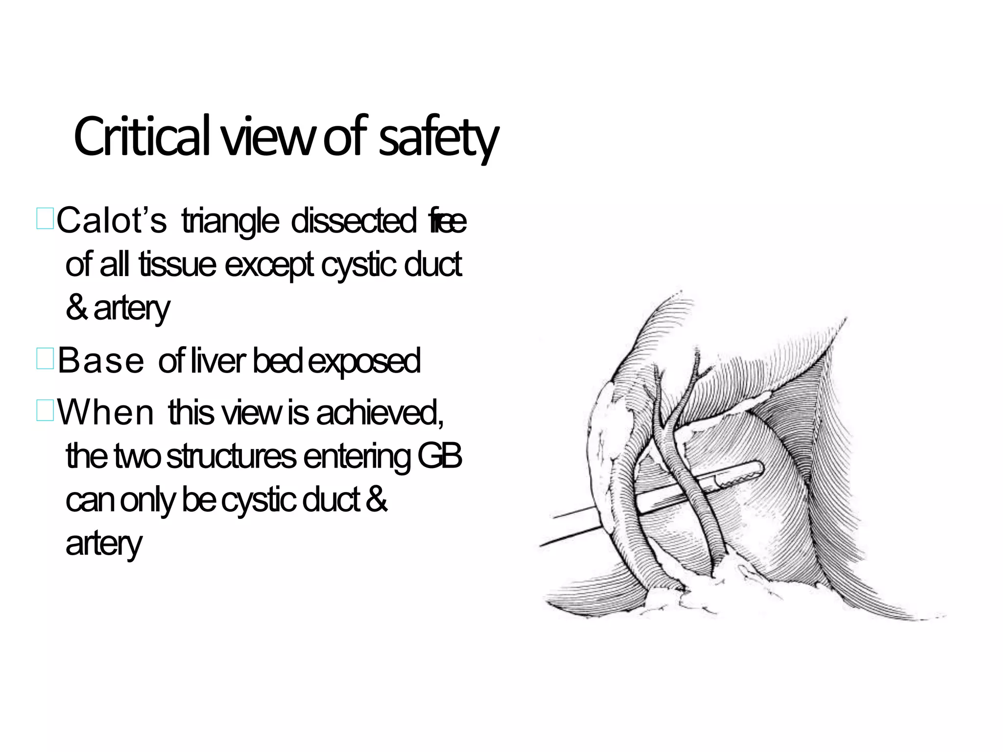 Bile Duct Injuries Ppt