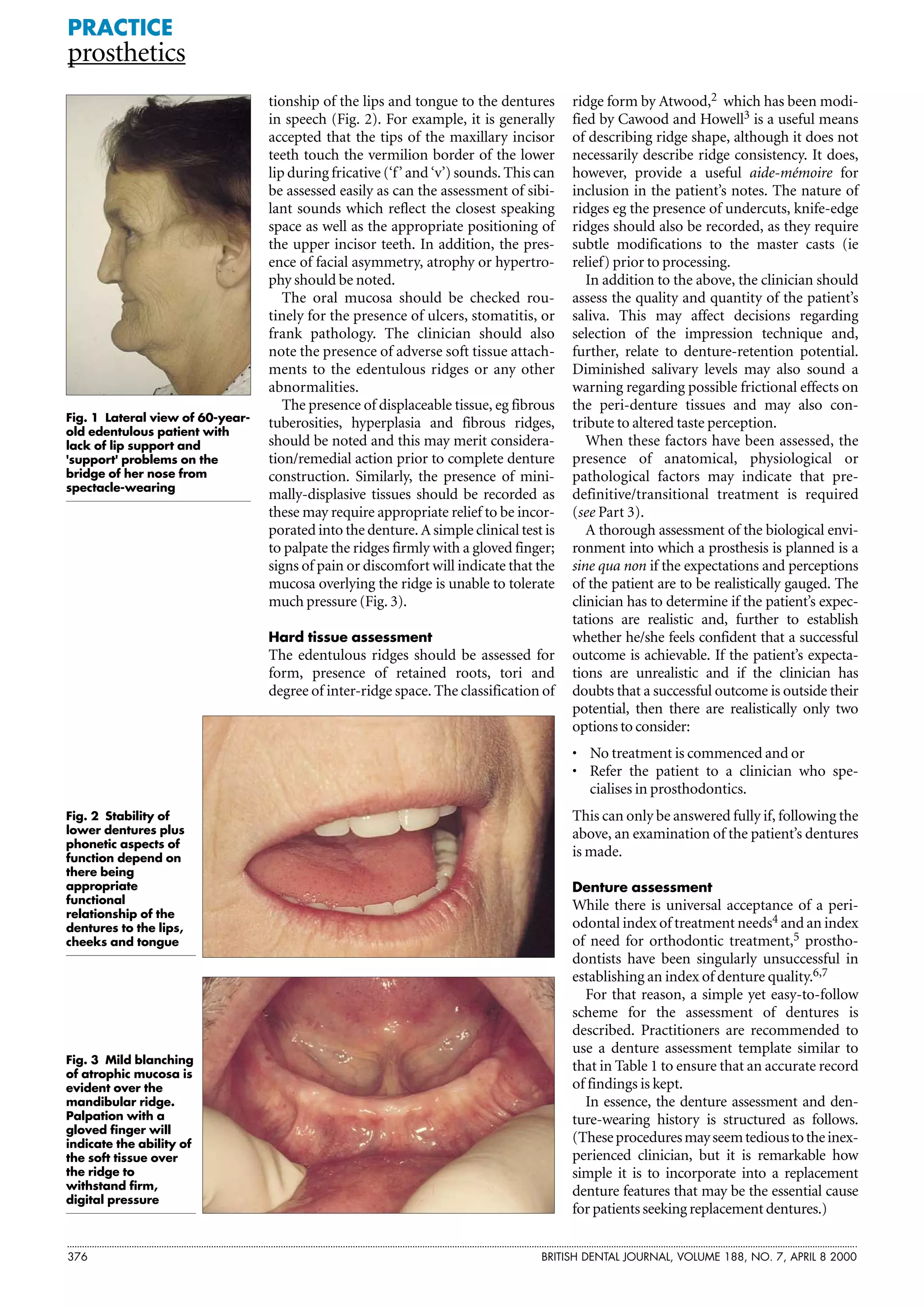 Bdj complete denture | PDF