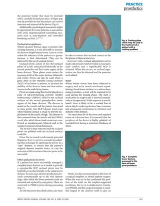 Bdj complete denture | PDF
