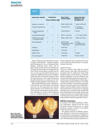 Bdj complete denture | PDF