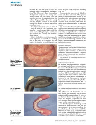 Bdj complete denture | PDF