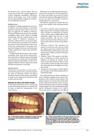 Bdj complete denture | PDF