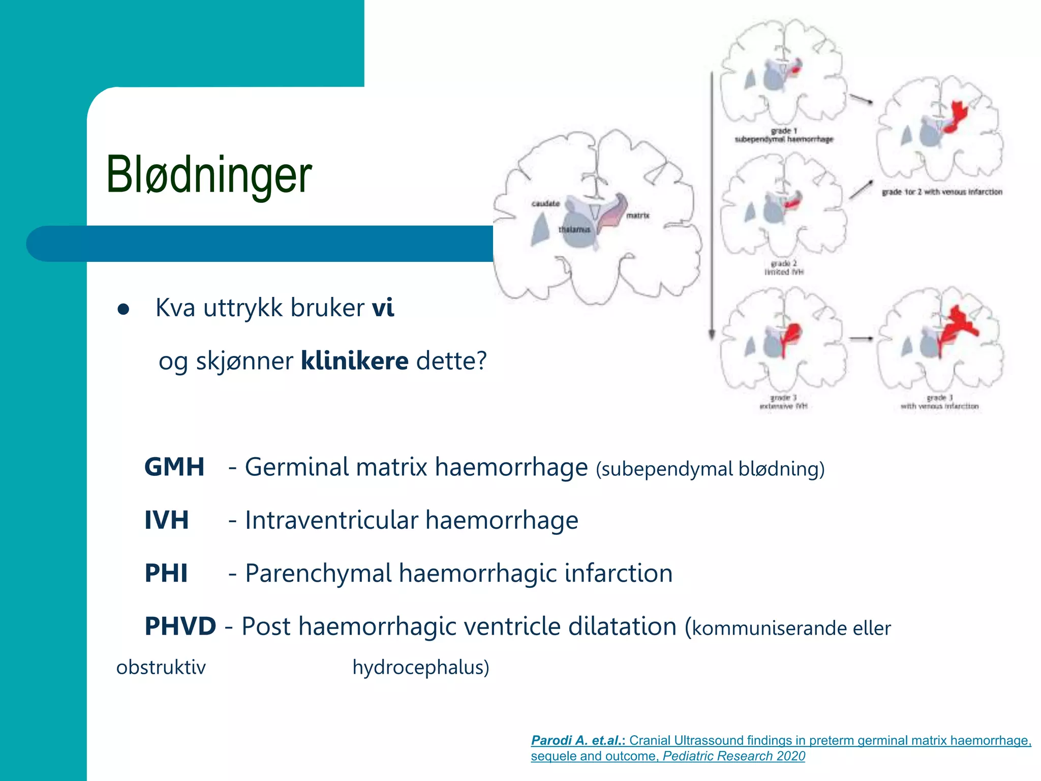 Cerebral ultralyd | PPT