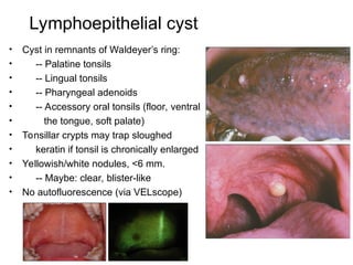 BDS 2022 cysts of oral and perioral soft tissues.ppt