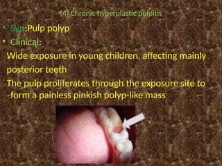 BDS_2025_Sequelae_of_Dental_caries,_resorption,_hypercementosis.pptx