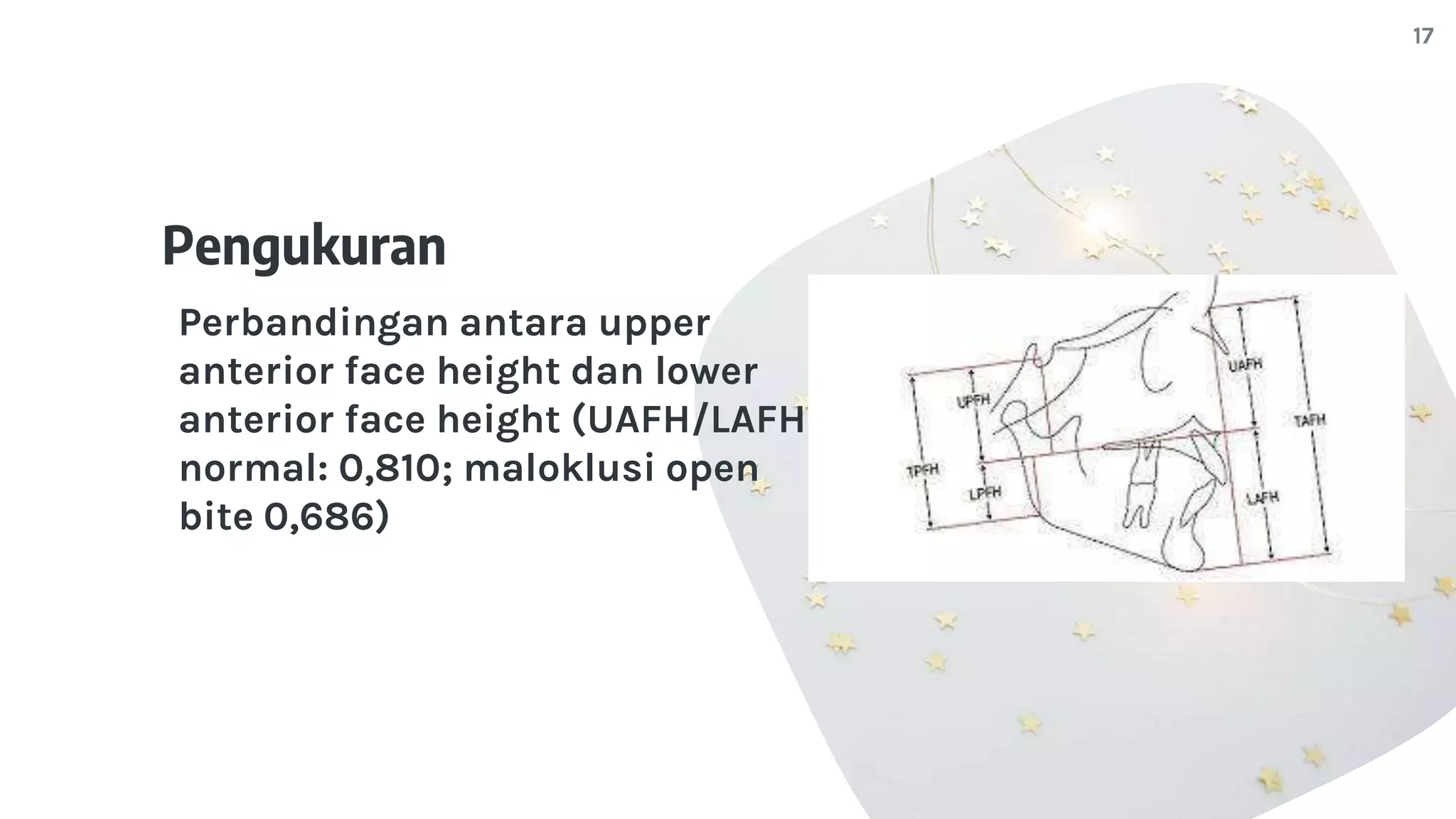 Jenis-jenis Maloklusi (Malposisi, Crowding, Open Bite) | PPTX