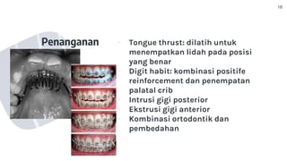 Jenis-jenis Maloklusi (Malposisi, Crowding, Open Bite) | PPTX