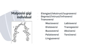 Jenis-jenis Maloklusi (Malposisi, Crowding, Open Bite) | PPTX