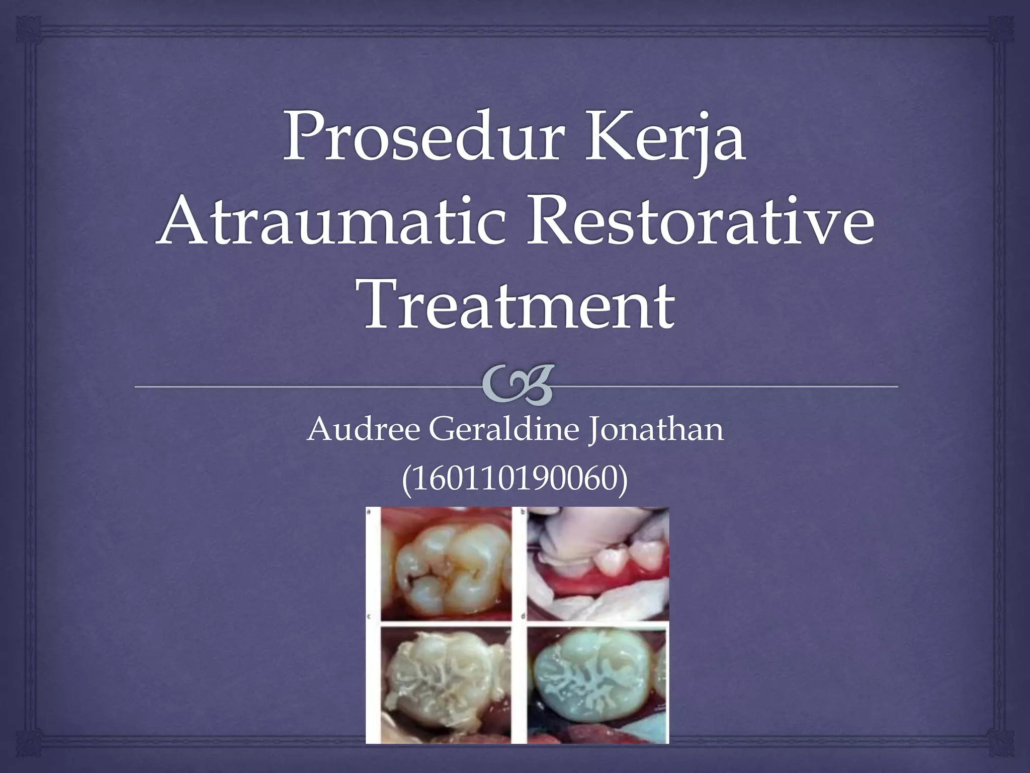 Prosedur Kerja Atraumatic Restorative Treatment (Preparasi ...