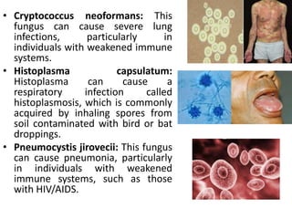 Pharmacology of Antifungal drugs for BDS Students .pdf