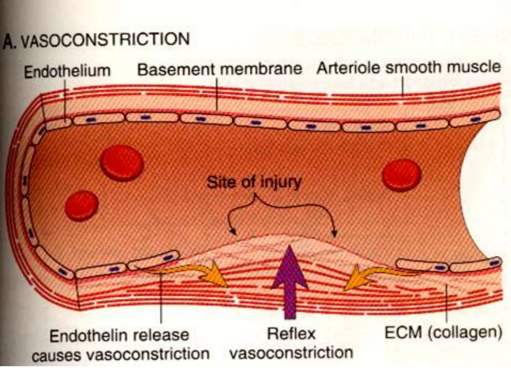 Bleeding Disorder Hemostasis Thrombocytopenia, ITP.ppt | Free Download