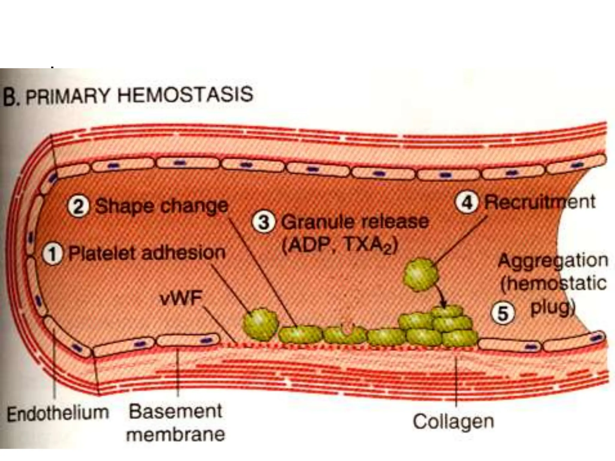 Bleeding Disorder Hemostasis Thrombocytopenia, ITP.ppt | Free Download