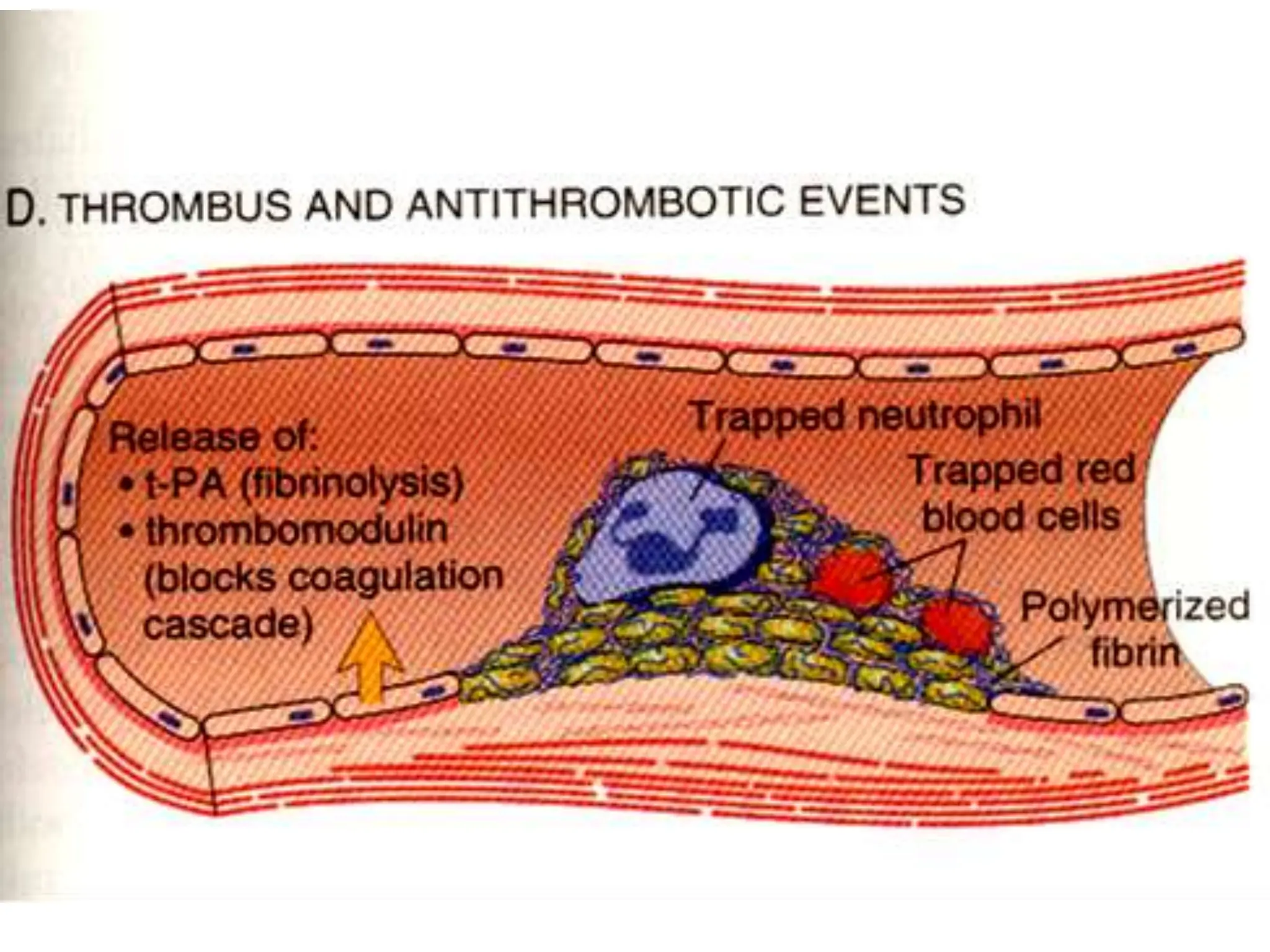 Bleeding Disorder Hemostasis Thrombocytopenia, ITP.ppt | Free Download