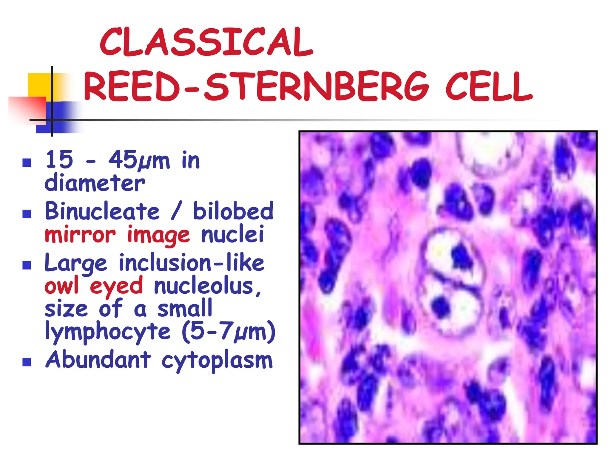 CLASSIFICATION DEFINITION & HODGKIN LYMPHOMA FOR BDS | PPT