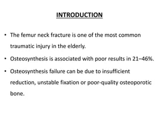 F technique for fracture neck femur | PPTX