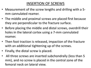 F technique for fracture neck femur | PPTX