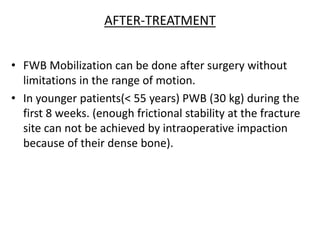 F technique for fracture neck femur | PPTX
