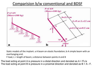 F technique for fracture neck femur | PPTX