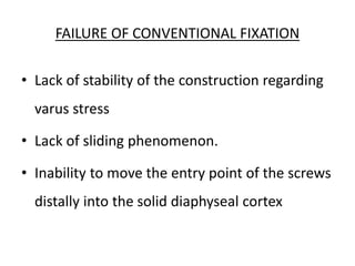 F technique for fracture neck femur | PPTX