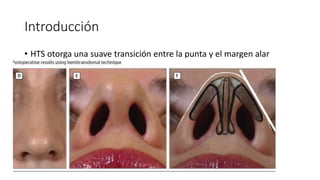 Binding dome suture vs hemitransdomal tip´ | PPTX