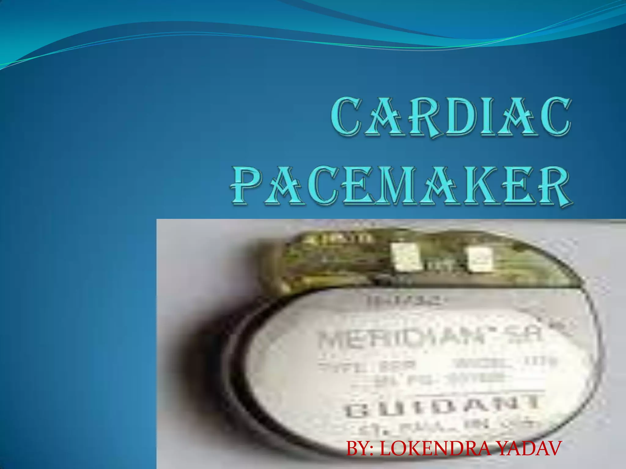 Cardiac Pacemaker | PPTX