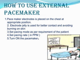 Cardiac Pacemaker | PPTX