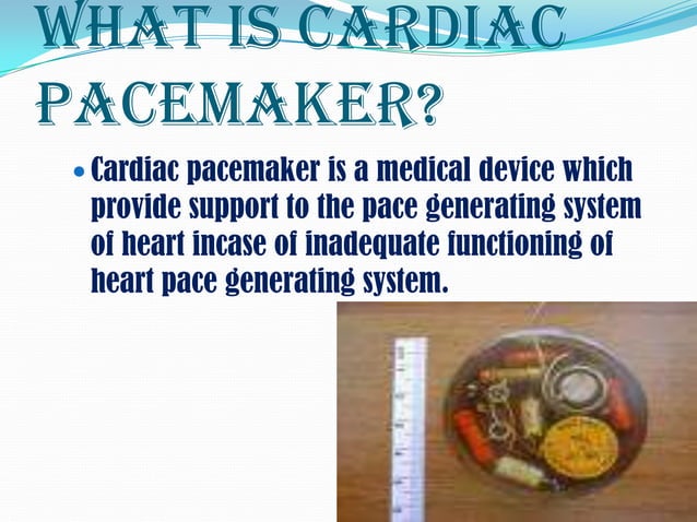 Cardiac Pacemaker | PPTX