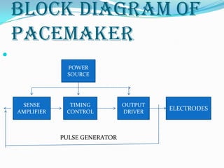 Cardiac Pacemaker | PPT