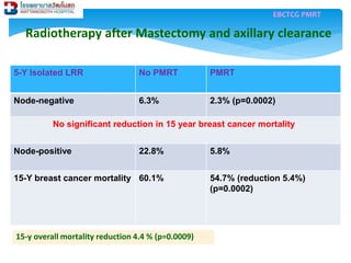 Updates in Radiotherapy for Breast Cancer | PPT