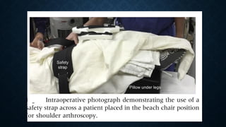 Beach chair position a short introduction | PDF