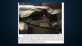 Beach chair position a short introduction | PDF