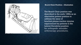 Beach chair position a short introduction | PDF