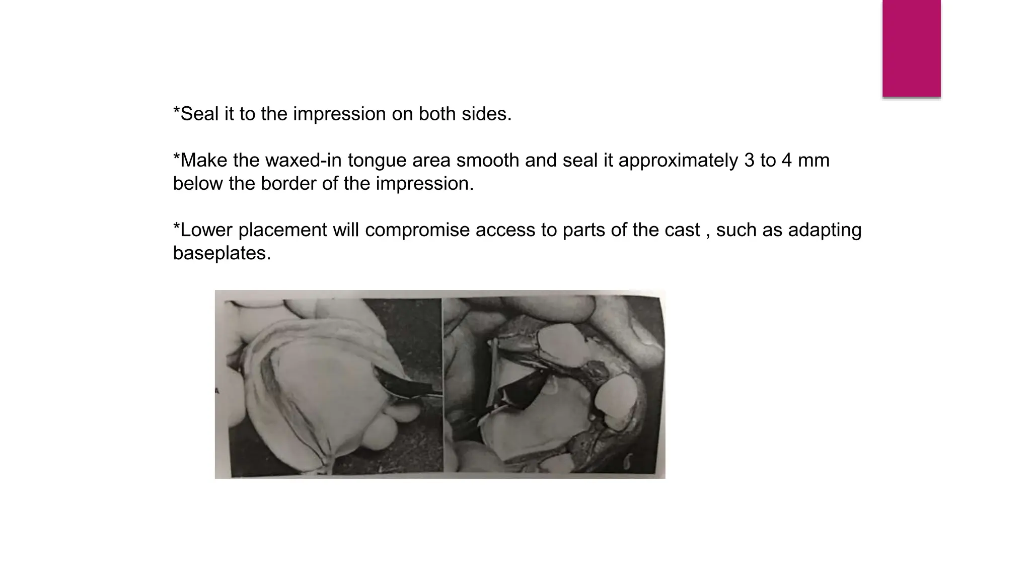 BEADING AND BOXING.ppt bds 1st year dental material | PPSX