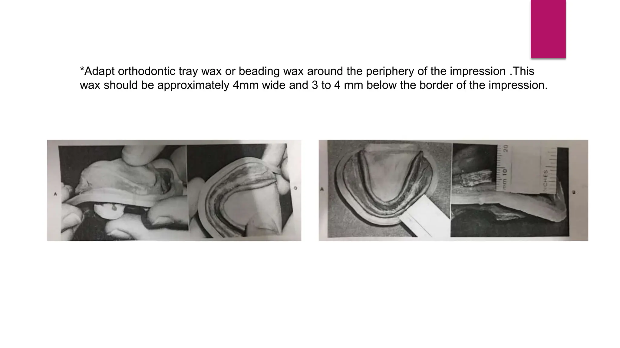 BEADING AND BOXING.ppt bds 1st year dental material | PPSX