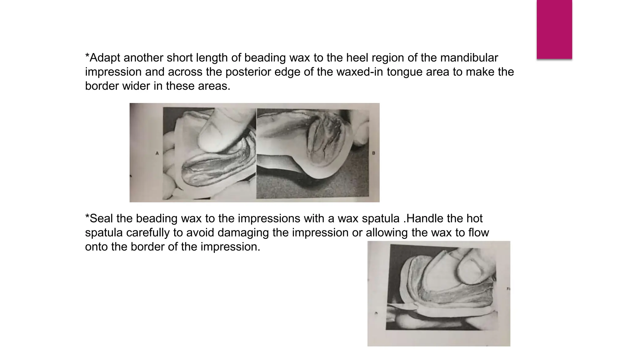 BEADING AND BOXING.ppt bds 1st year dental material | PPSX