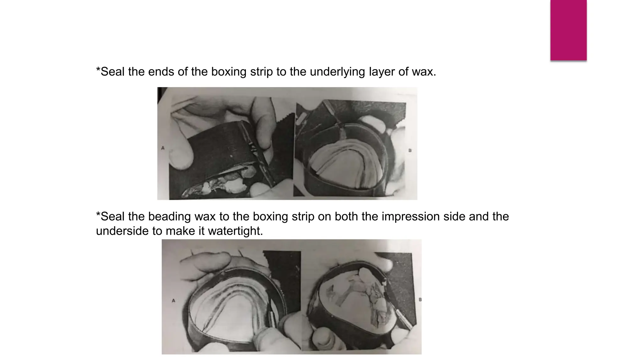BEADING AND BOXING.ppt bds 1st year dental material | PPSX