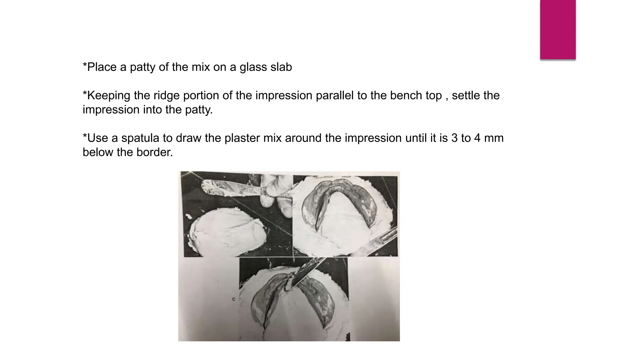 BEADING AND BOXING.ppt bds 1st year dental material | PPSX