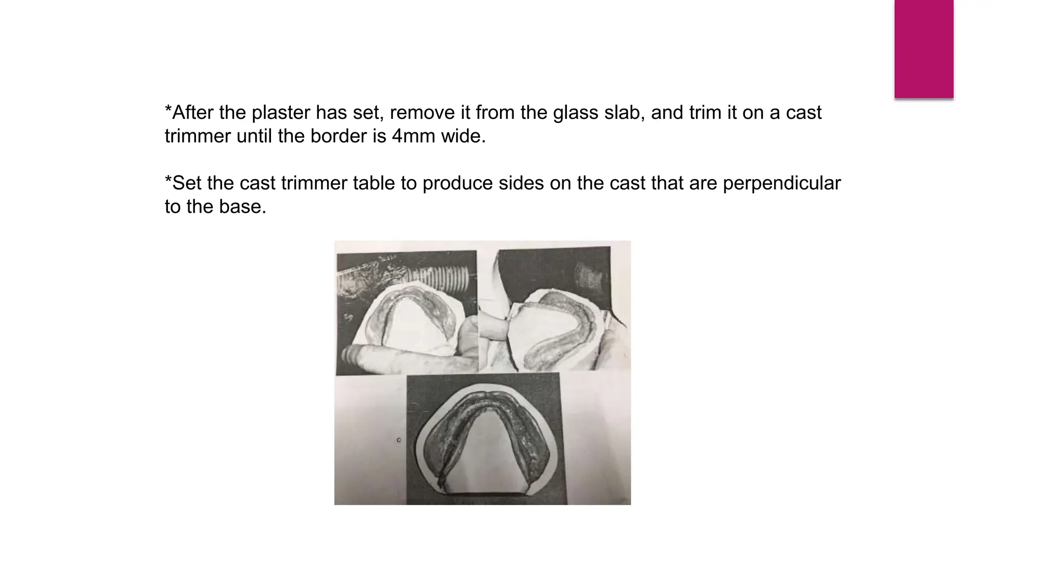 BEADING AND BOXING.ppt bds 1st year dental material | PPSX