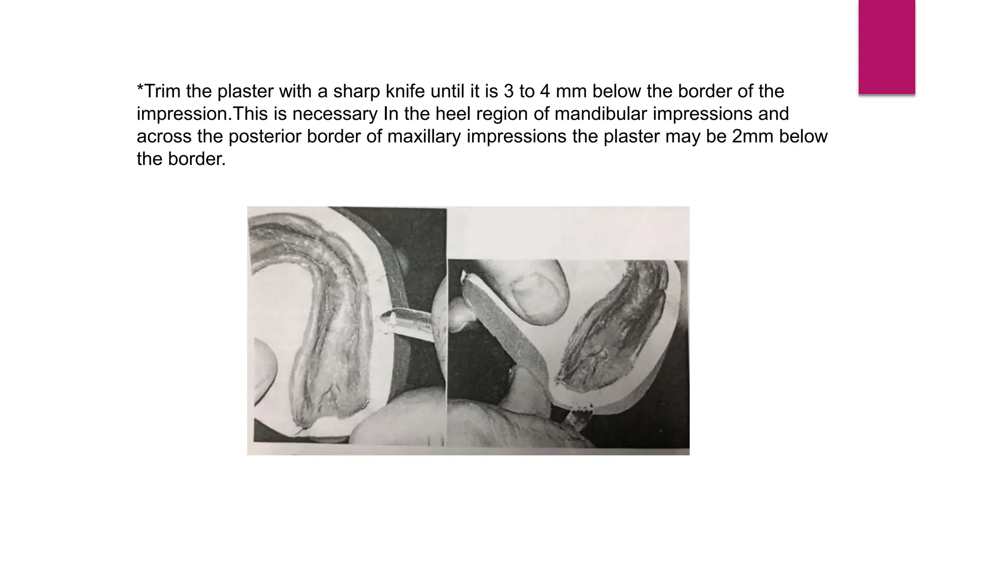BEADING AND BOXING.ppt bds 1st year dental material | PPSX
