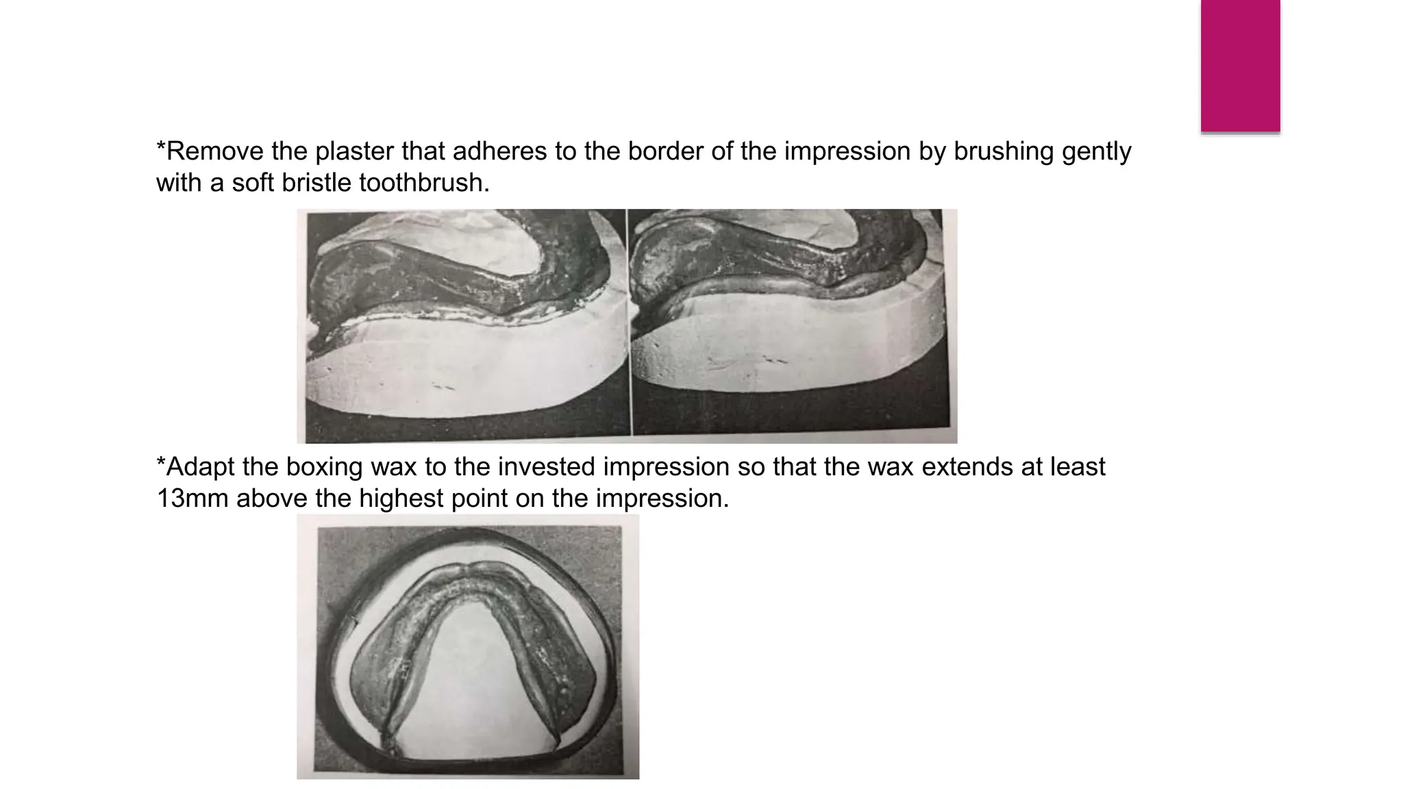 BEADING AND BOXING.ppt bds 1st year dental material | PPSX