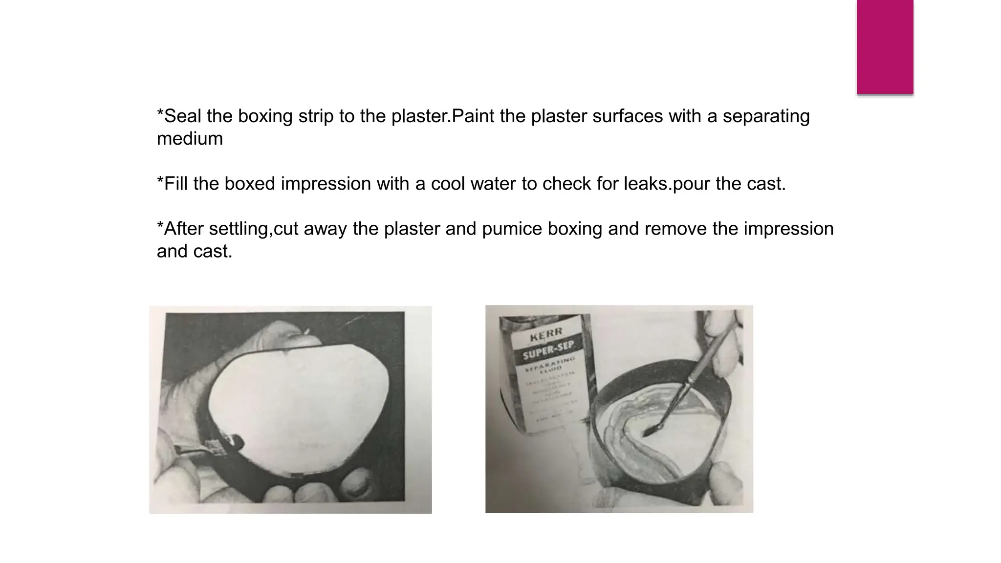 BEADING AND BOXING.ppt bds 1st year dental material | PPSX