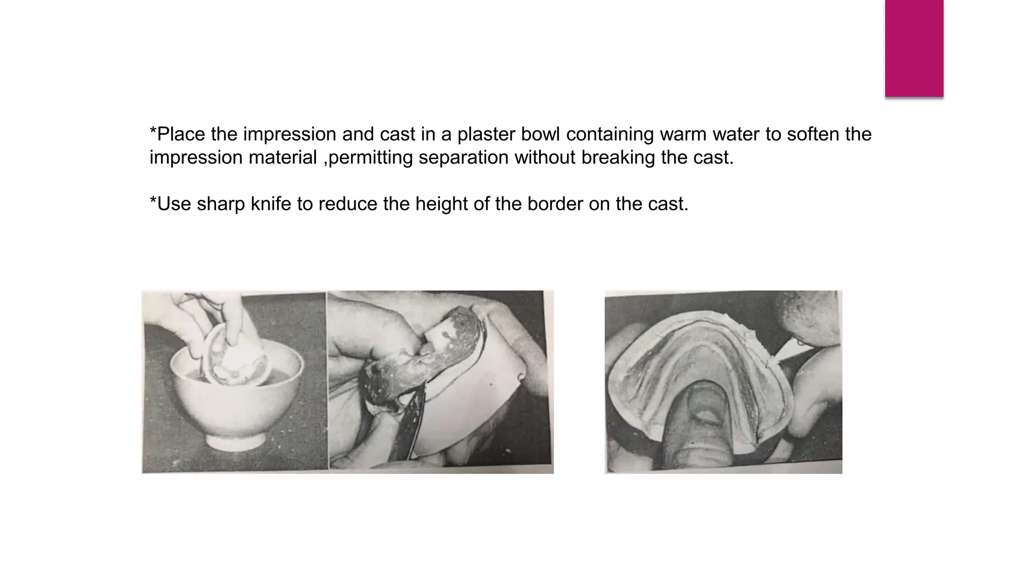 BEADING AND BOXING.ppt bds 1st year dental material | PPSX